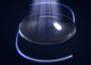 Cataract Surgery Washington, DC | Light Adjustable Lens Vienna