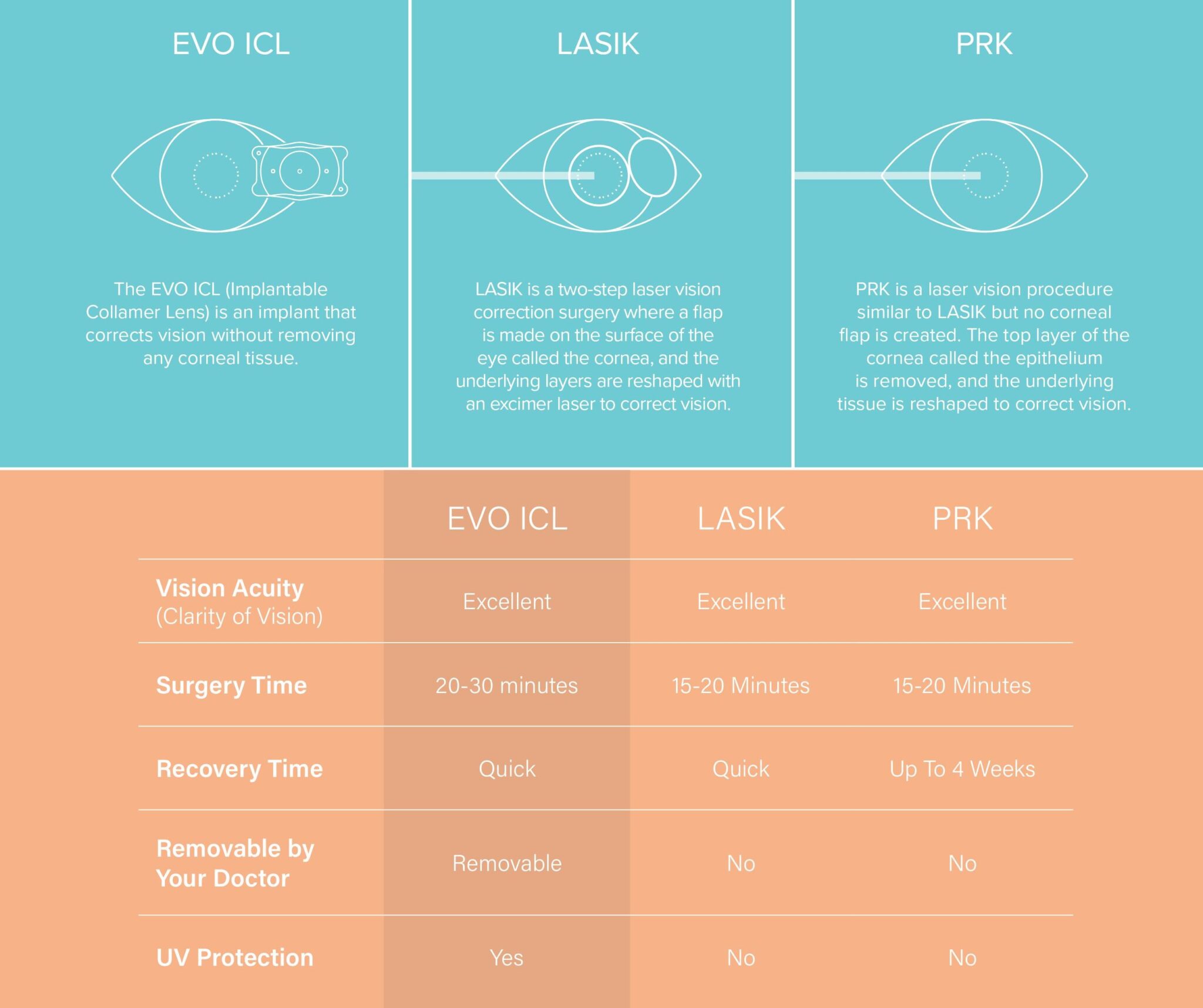EVO ICL | Eye Doctors of Washington